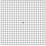 How is Age-Related Macular Degeneration Diagnosed? | AMDF