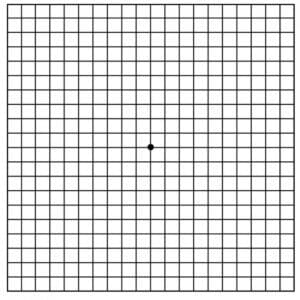 Diagnosing Age-related Macular Degeneration - AMDF