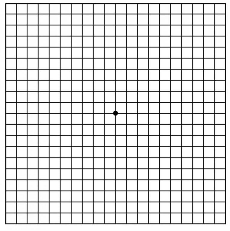 Diagnosing Age-related Macular Degeneration - AMDF
